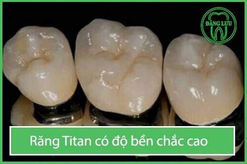 Răng sứ Titan là gì? Quy trình bọc sứ Titan như thế nào?